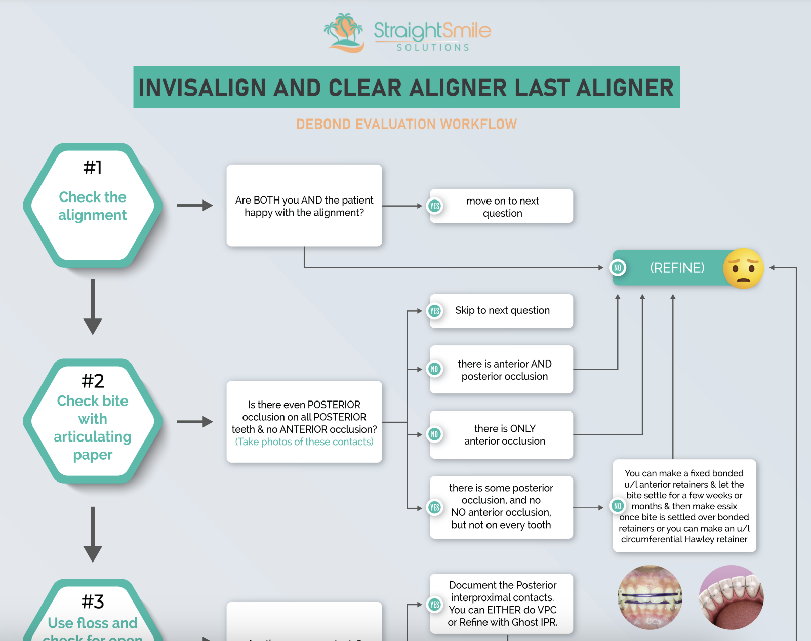 Debond Workflow - Clear Aligner - Dental Success Network